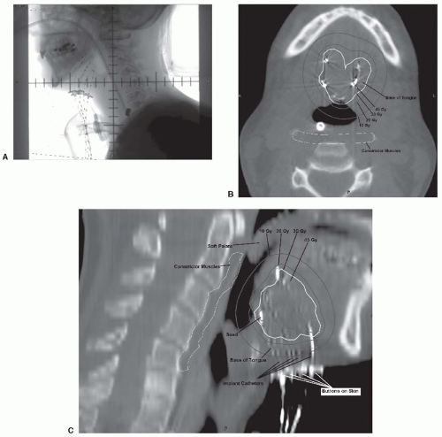 Radiologic Imaging Considerations | Oncohema Key